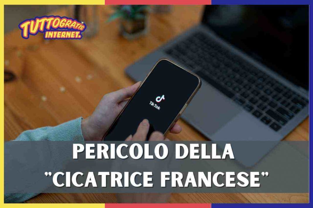 Tiktok La Cicatrice Francese è Virale Allarme Tra I Più Giovani